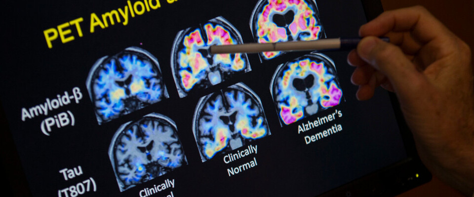 Harry Rakowski: The problem of dementia: Understanding and living with ...